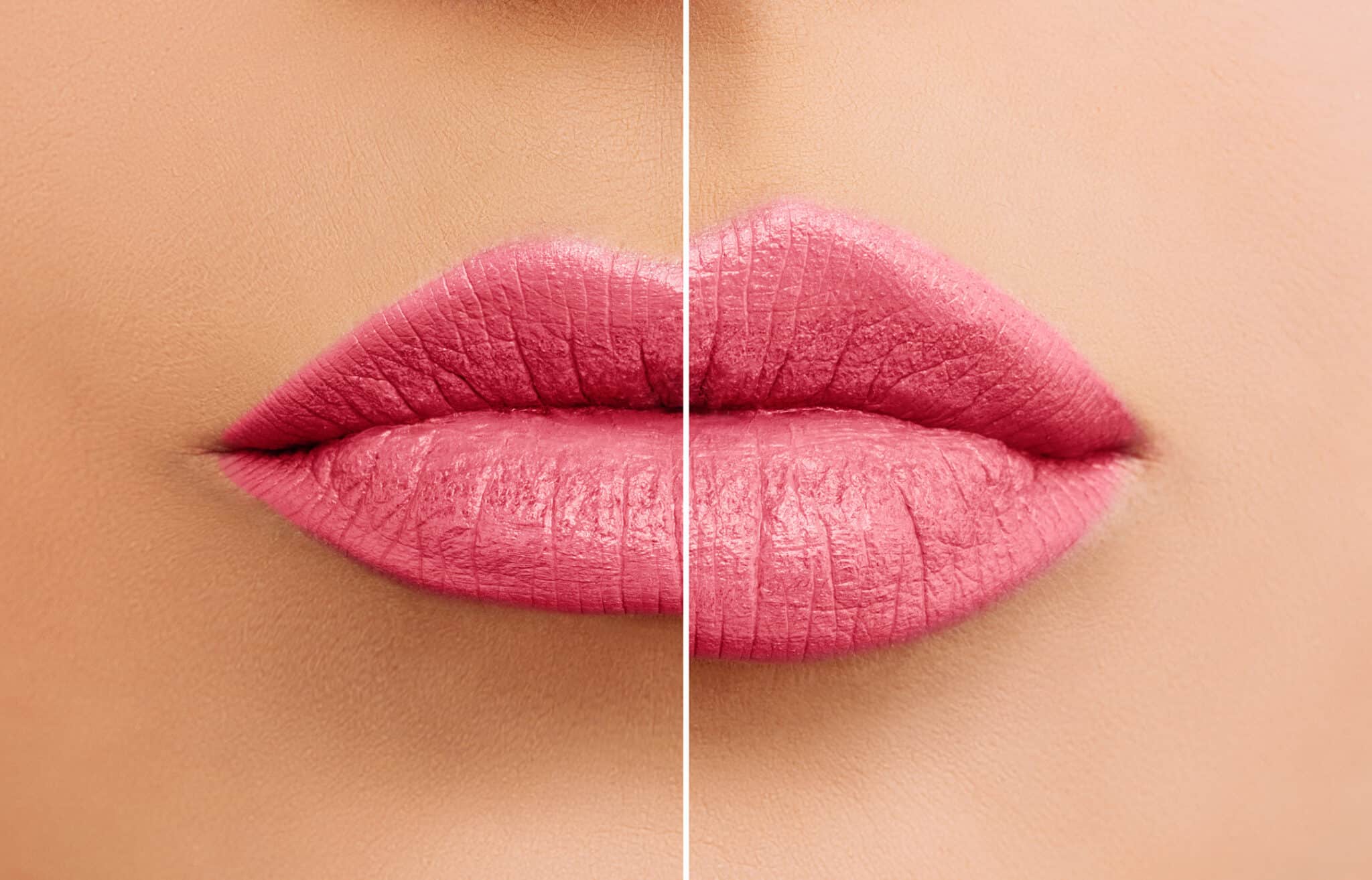 Lip Enhancements | Youthful Infusion MedSpa | Allen, TX