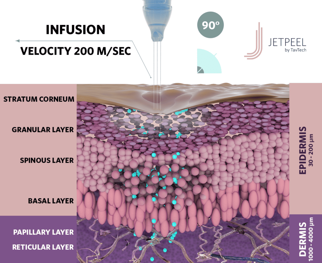 Jet Peels | Youthful Infusion MedSpa | Allen, TX
